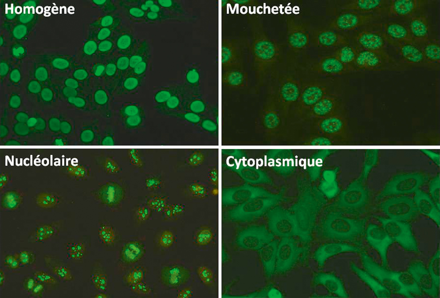 Pathologies auto-immunes : aspects épidémiologiques, diagnostiques et ...